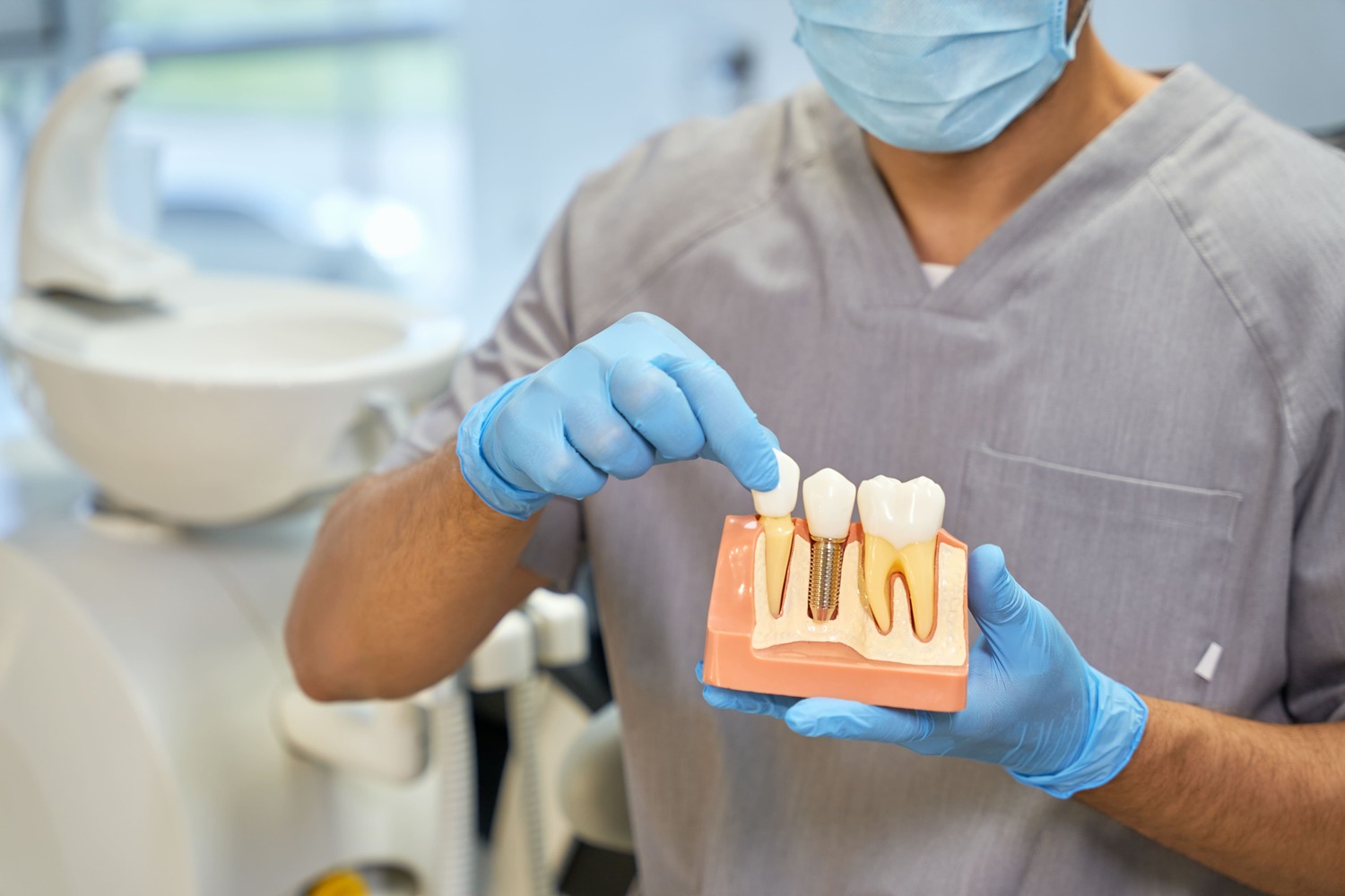 The Lifespan of Dental Implants: How Long Do They Last? - Ultra Smile ...